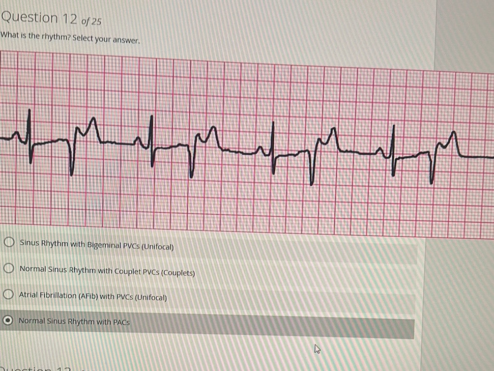 Question 12 of 25 What is the rhythm? Select | StudyX