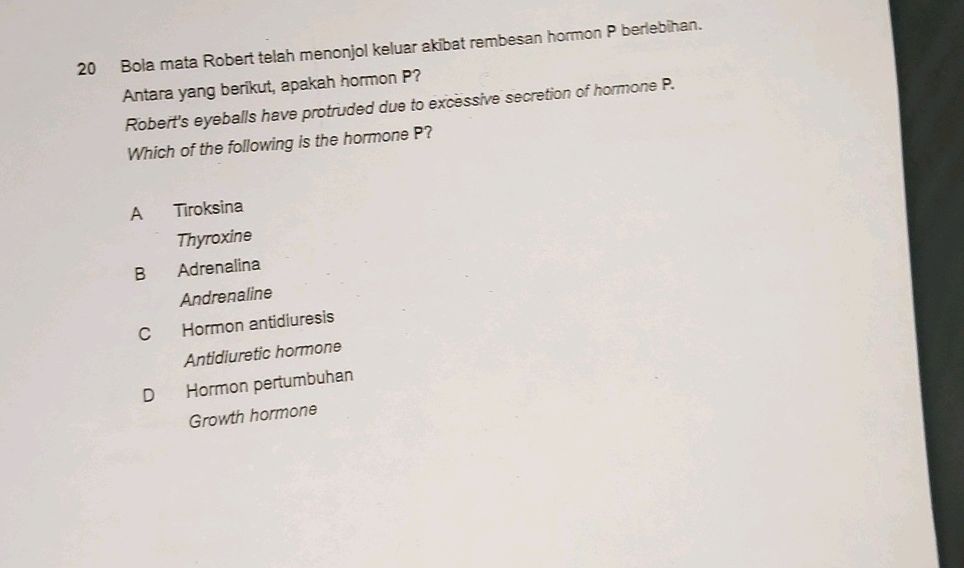 20 Bola mata Robert telah menonjol keluar | StudyX