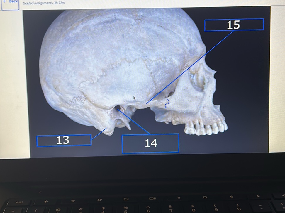 The image shows a skull with numbered | StudyX