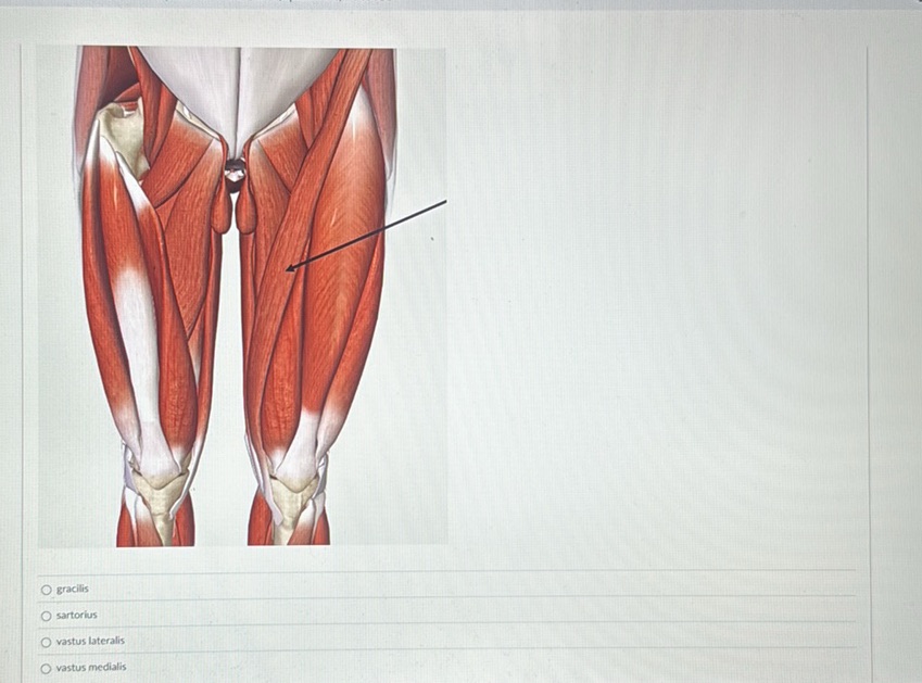 Which muscle is indicated by the arrow? * | StudyX