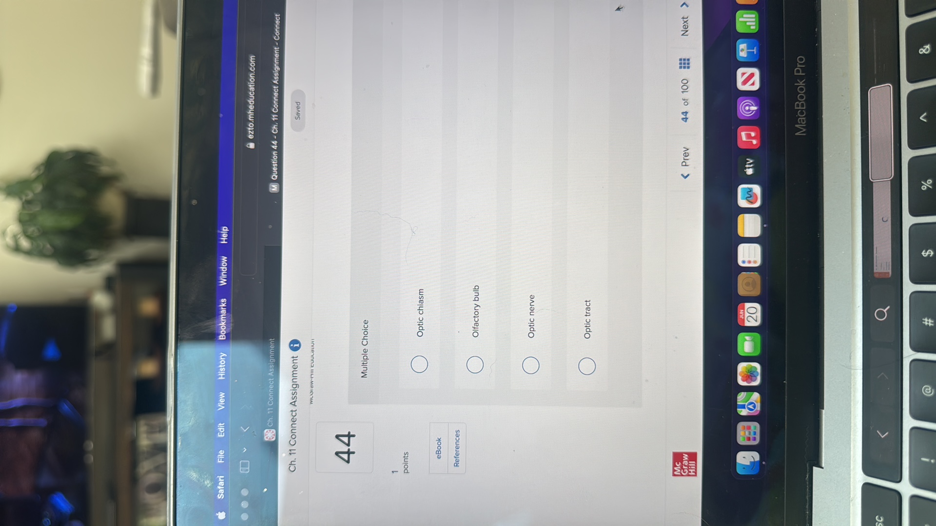 Identify the structure highlighted and | StudyX
