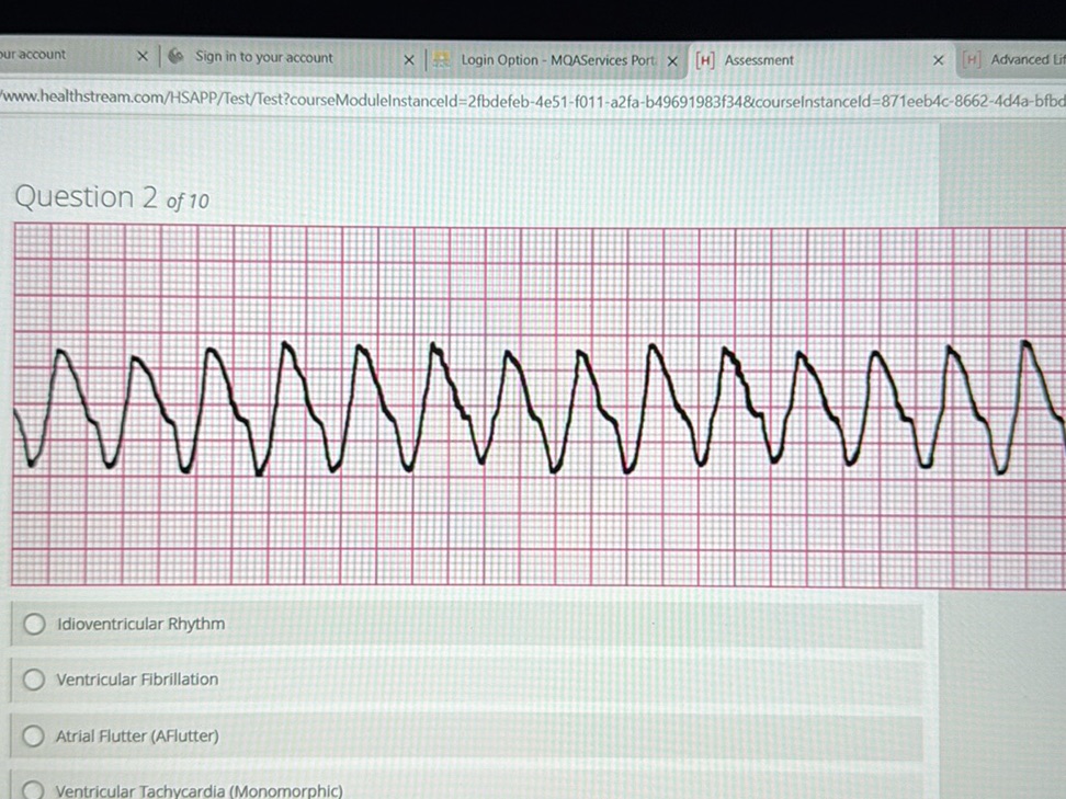 Question 2 of 10 Idioventricular Rhythm | StudyX
