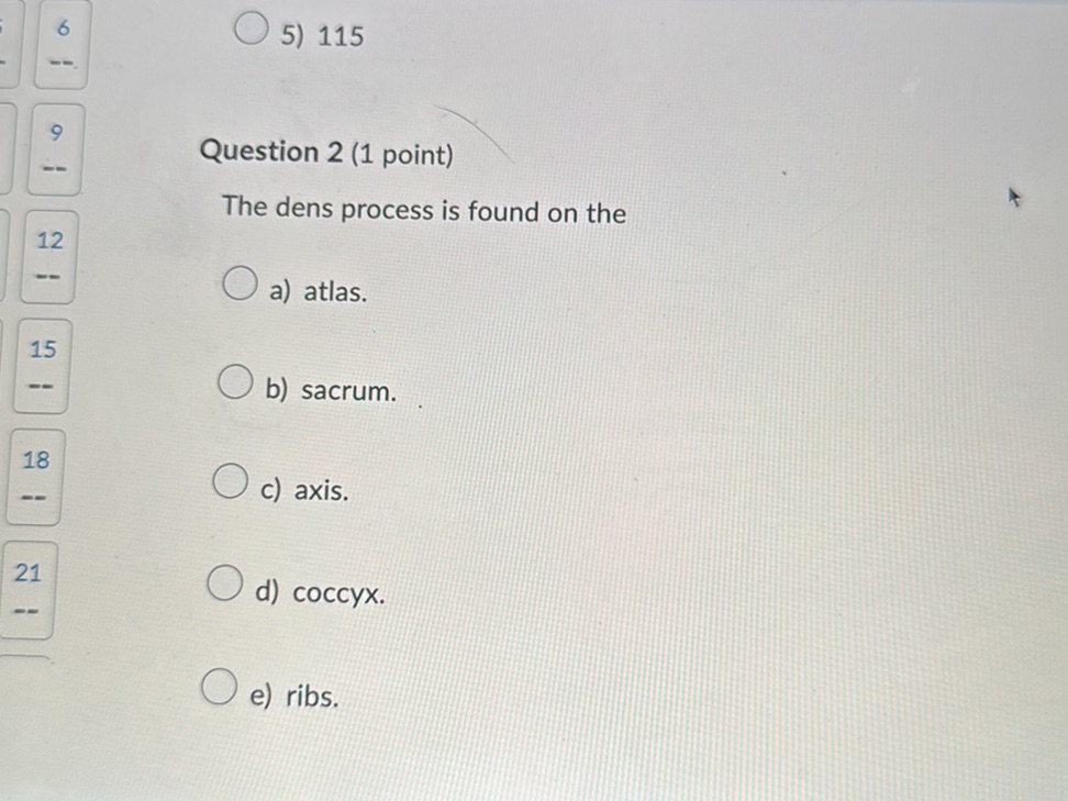 Question 2 (1 point) The dens process is | StudyX
