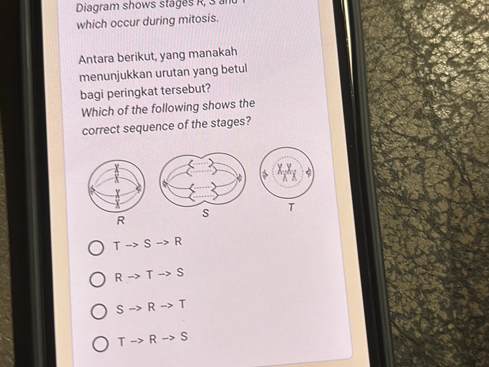 Diagram shows stages R, S and T which occur | StudyX