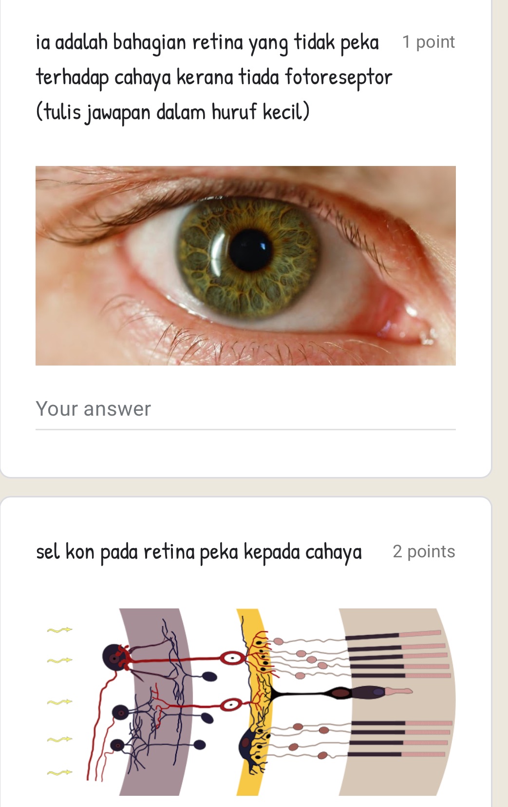 ia adalah bahagian retina yang tidak peka | StudyX