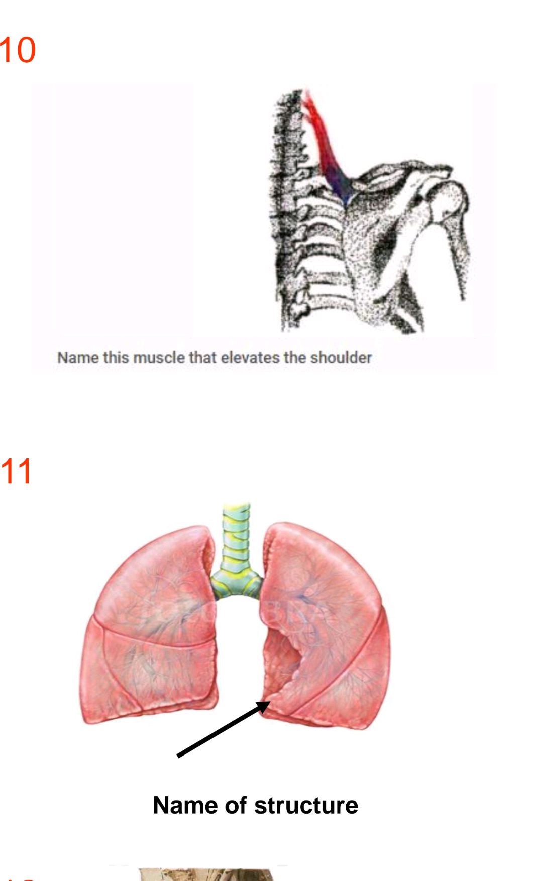 Name this muscle that elevates the shoulder | StudyX