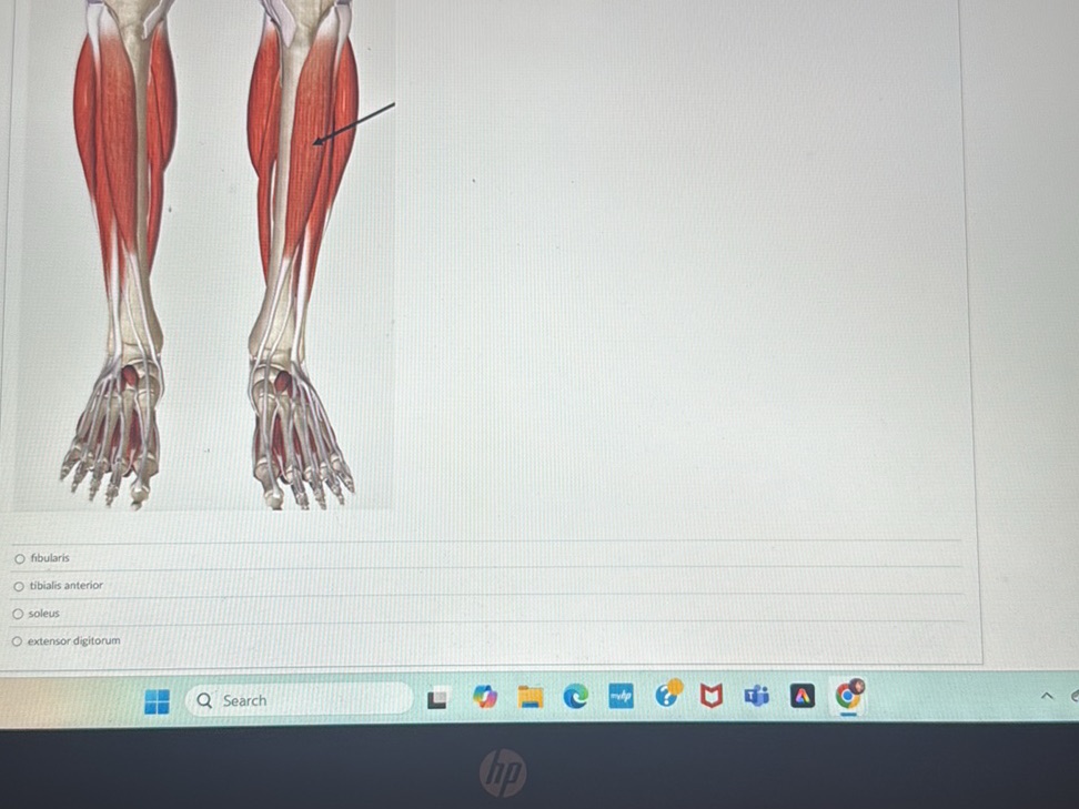 Which muscle is indicated by the arrow? O | StudyX