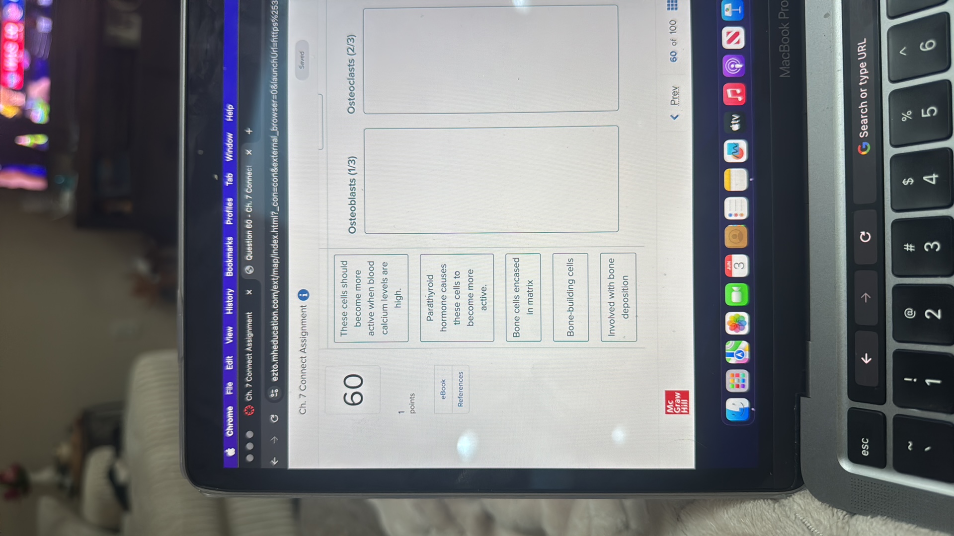 Identify the type of bone cell being | StudyX