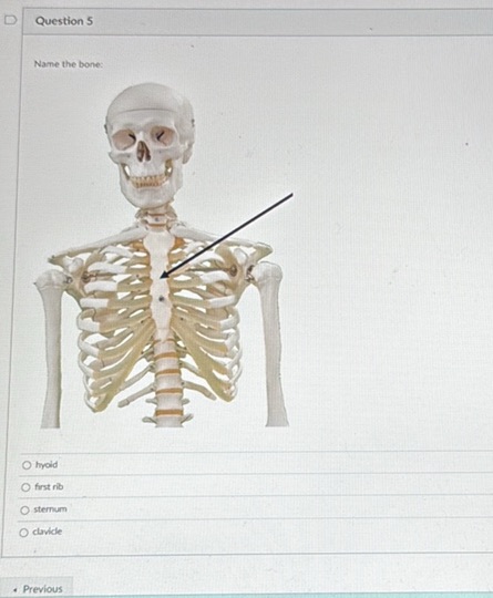 Name the bone: * hyoid * first rib * | StudyX