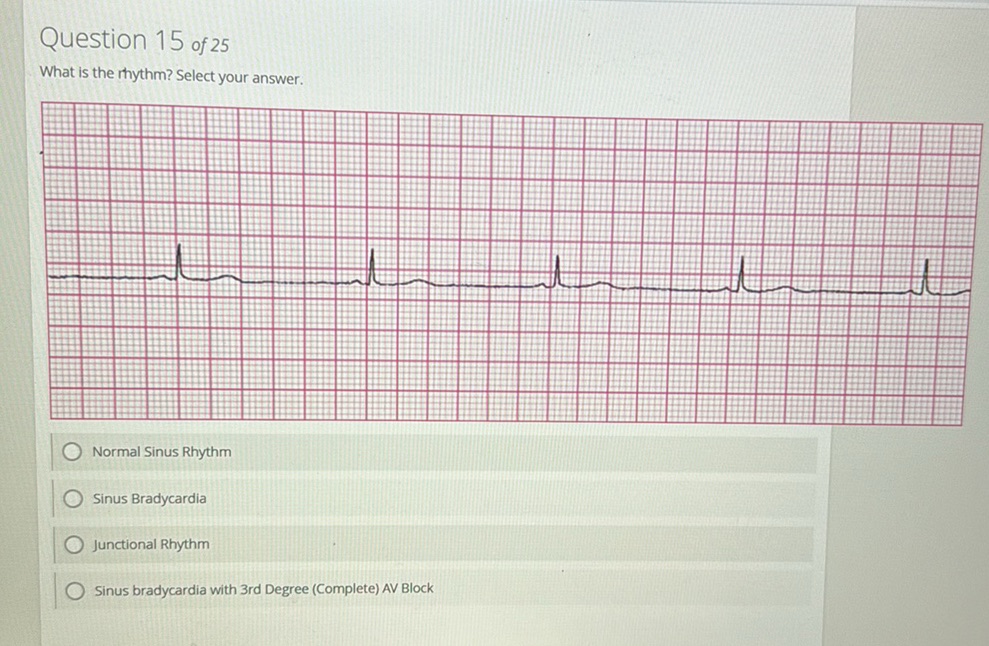 Question 15 of 25 What is the rhythm? Select | StudyX