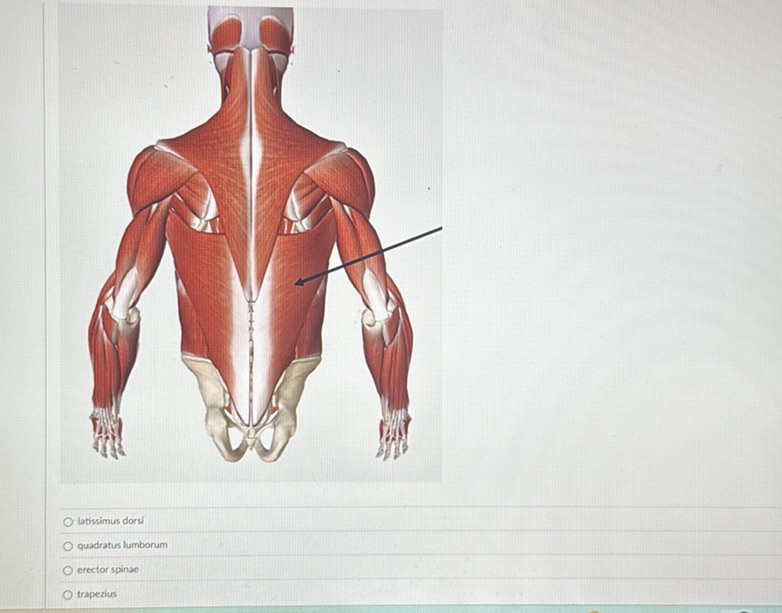Which muscle is indicated by the arrow? * | StudyX