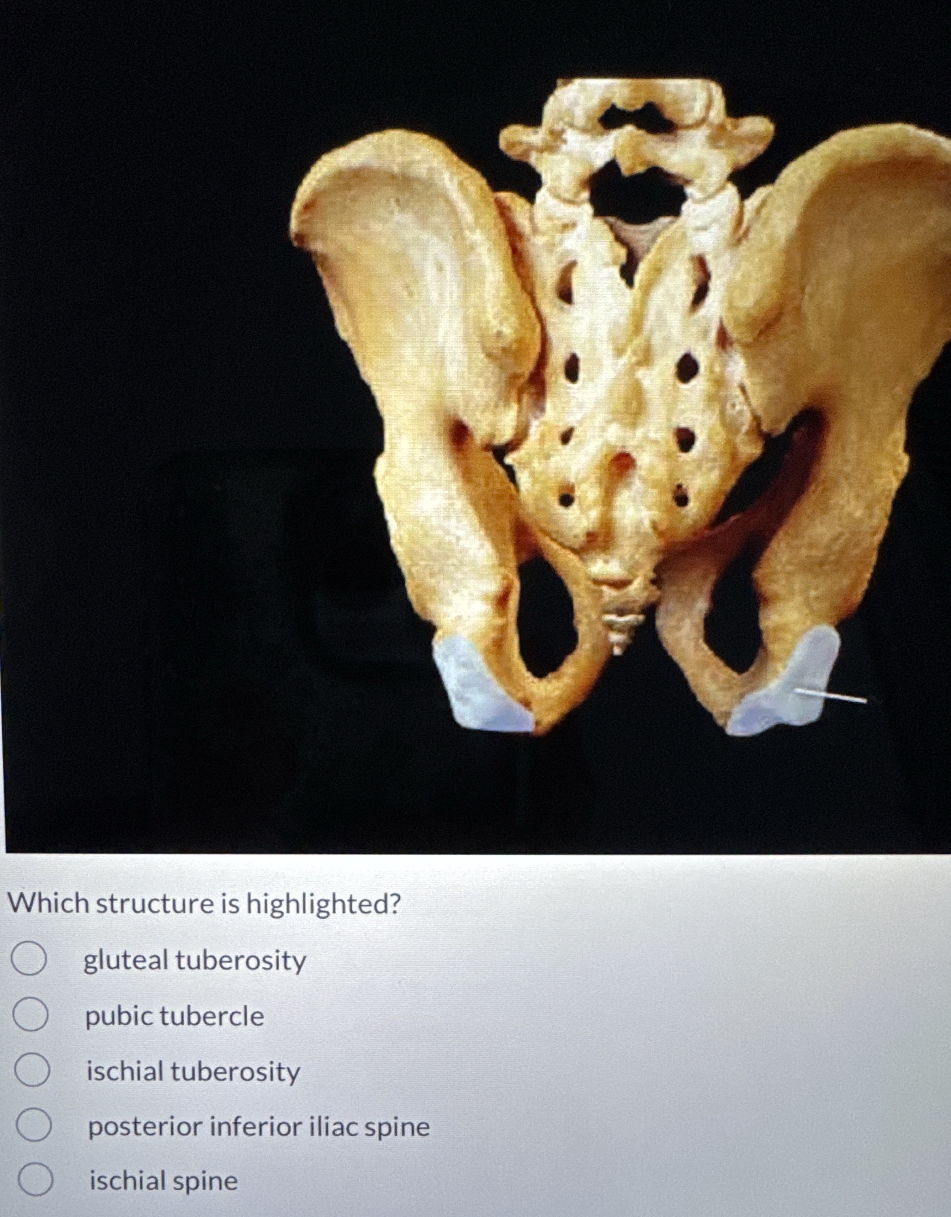 Which structure is highlighted? gluteal | StudyX