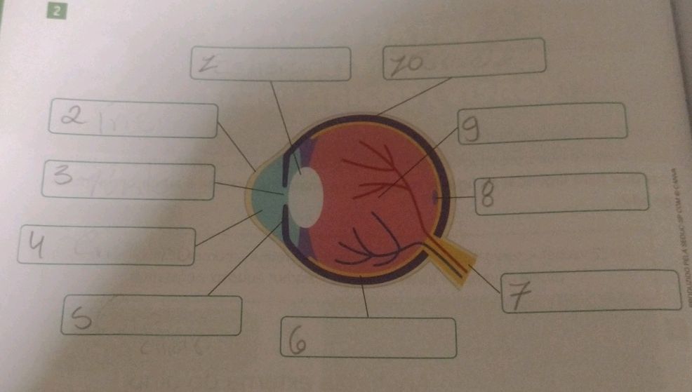 The image shows a diagram of an eye with | StudyX