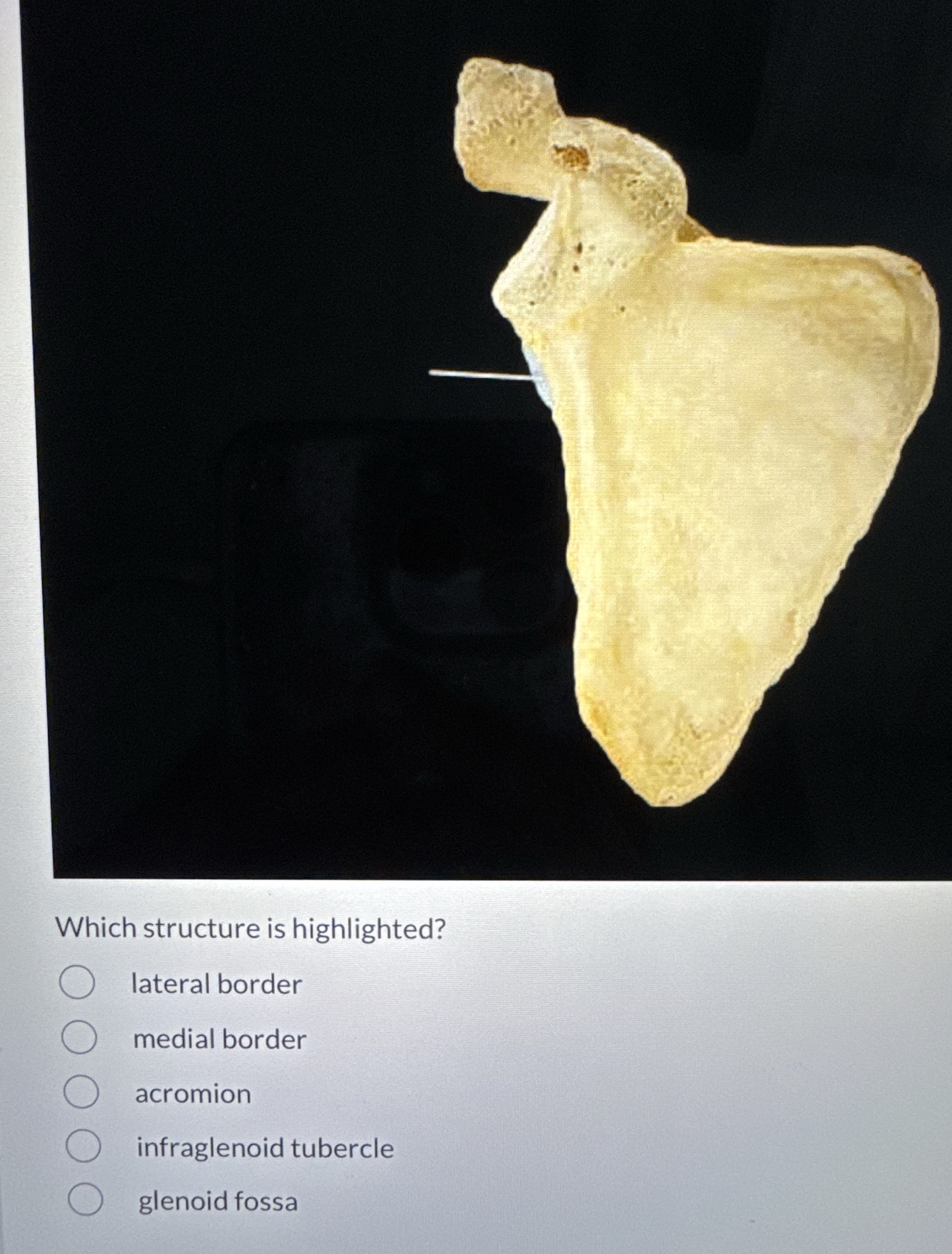 Which structure is highlighted? lateral | StudyX