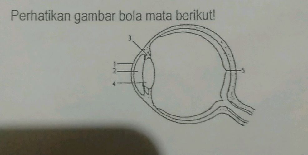 Perhatikan gambar bola mata berikut! (Image | StudyX