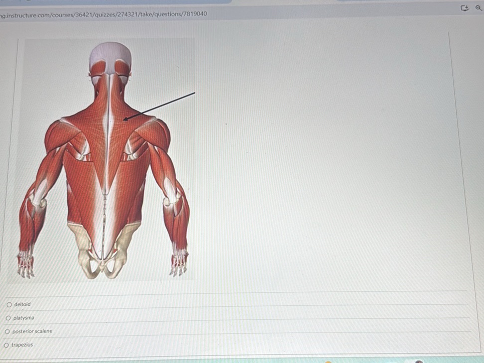 Which muscle is indicated by the arrow? | StudyX