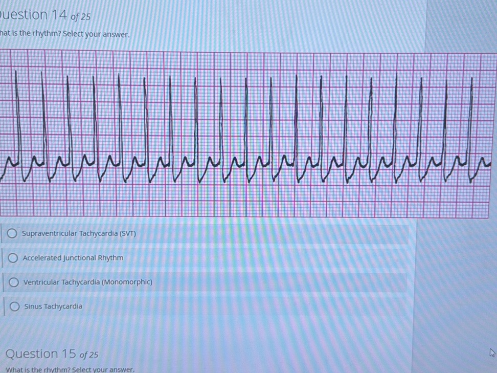 Question 14 of 25 What is the rhythm? Select | StudyX