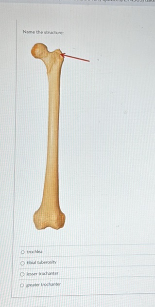 Name the structure: O trochlea O tibial | StudyX