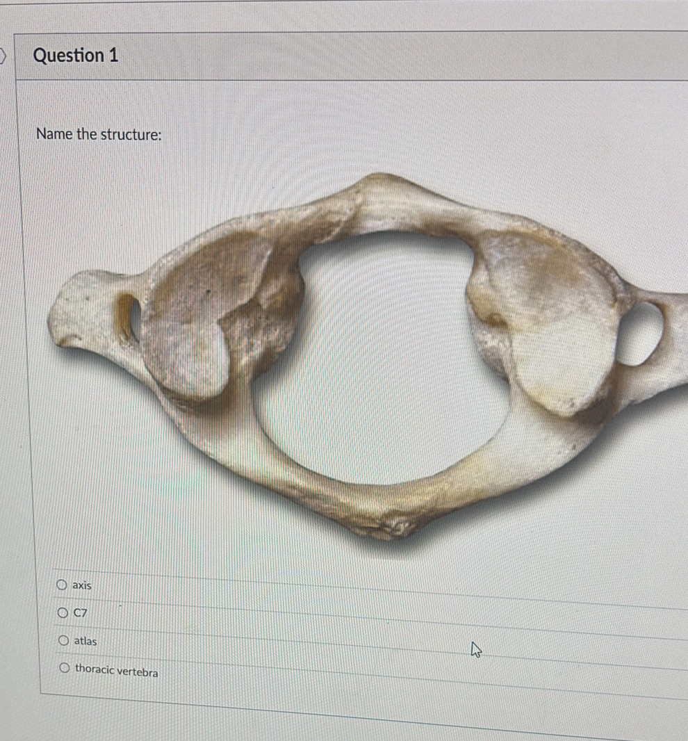 Question 1 Name the structure: axis C7 | StudyX