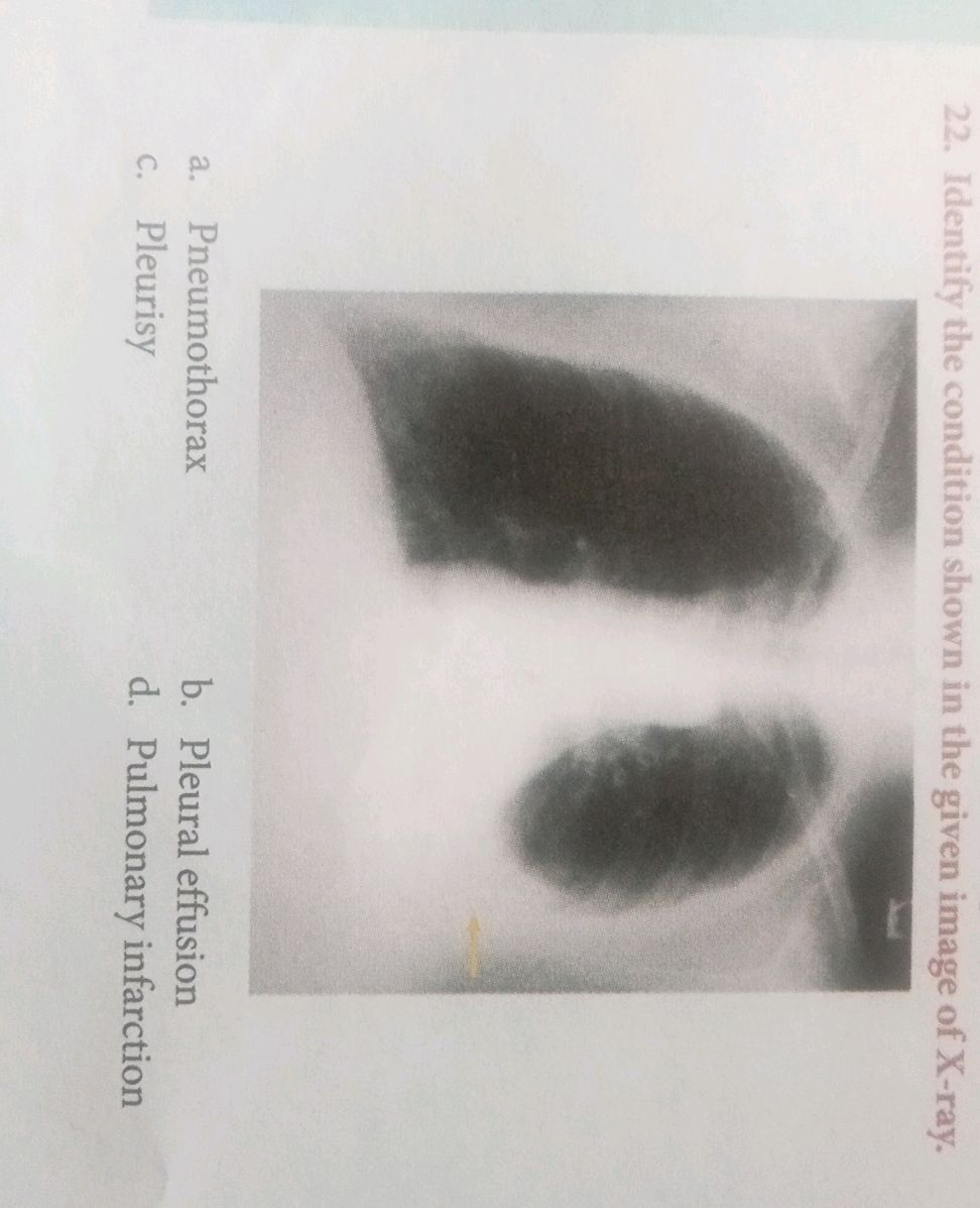 22. Identify the condition shown in the | StudyX