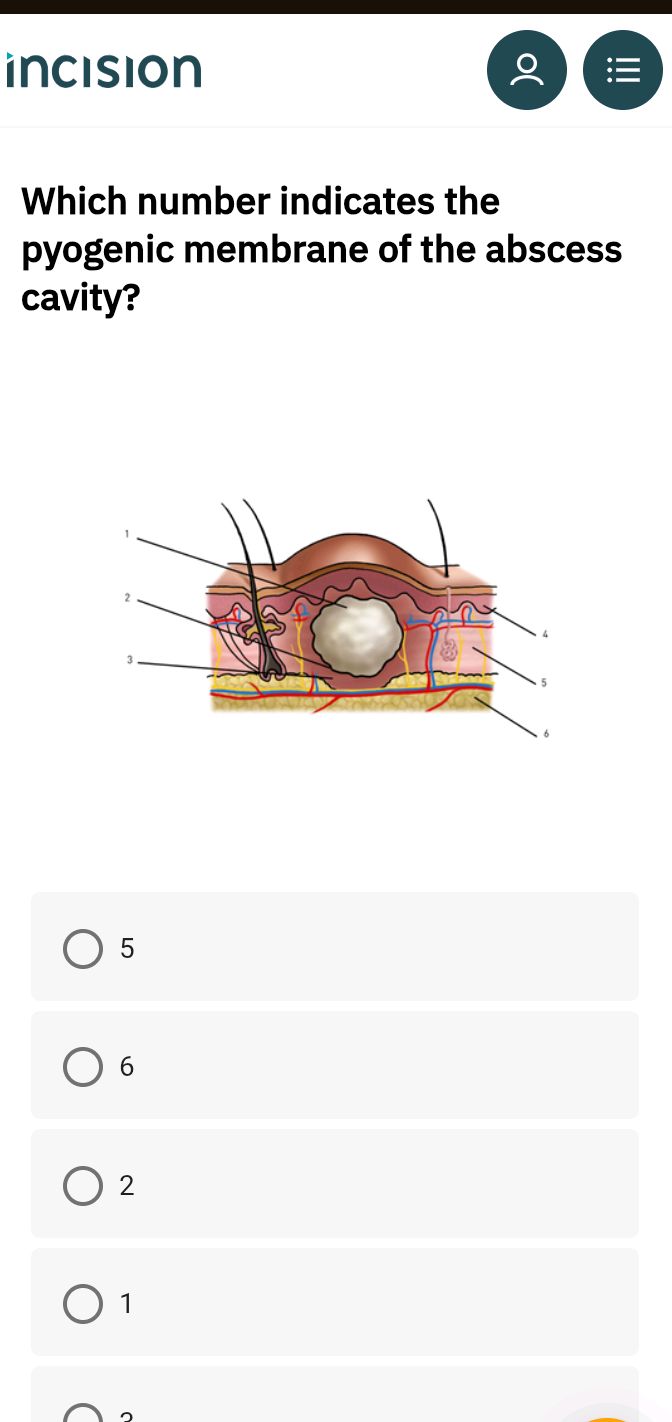 Which number indicates the pyogenic membrane | StudyX
