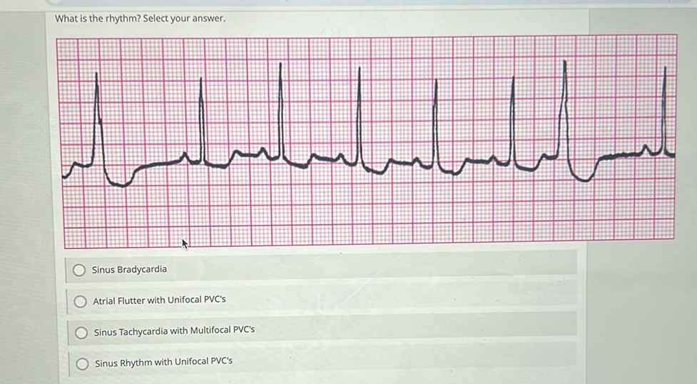 What is the rhythm? Select your answer. | StudyX