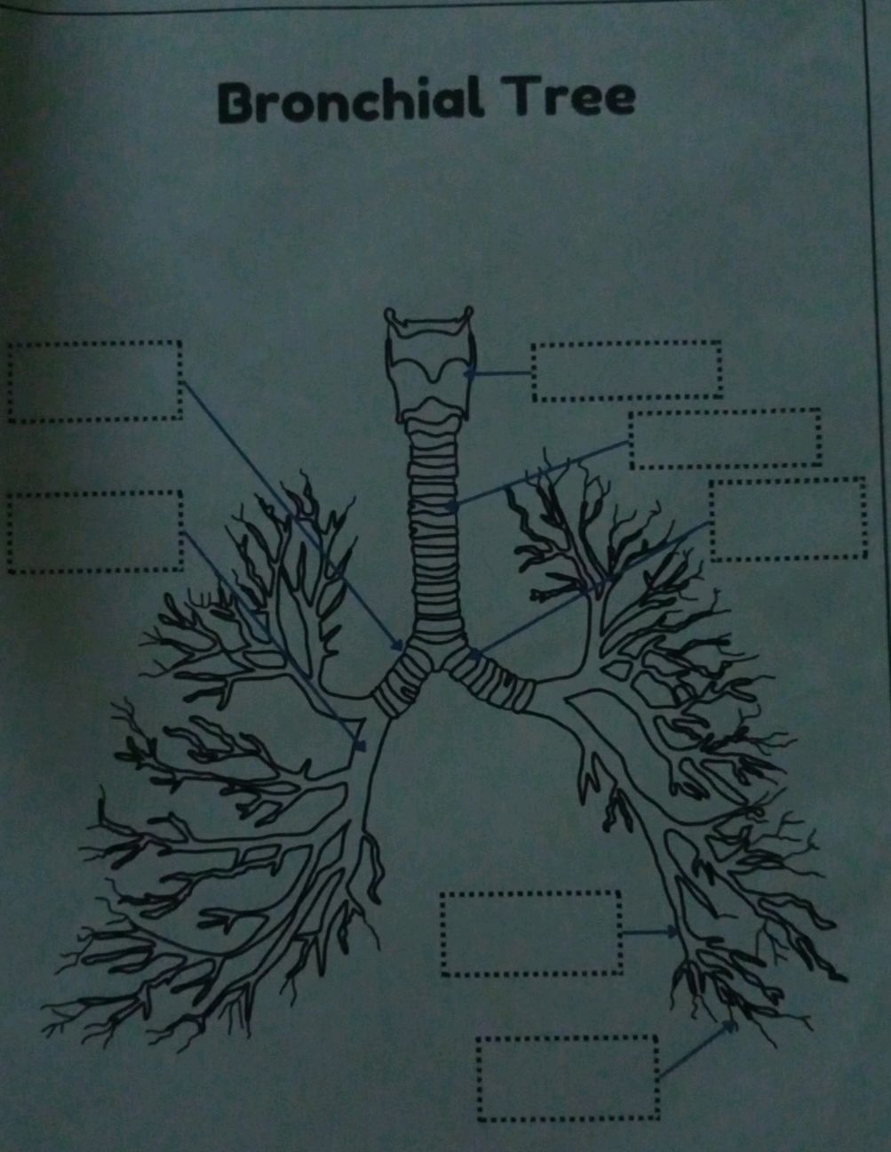 Label the parts of the bronchial tree