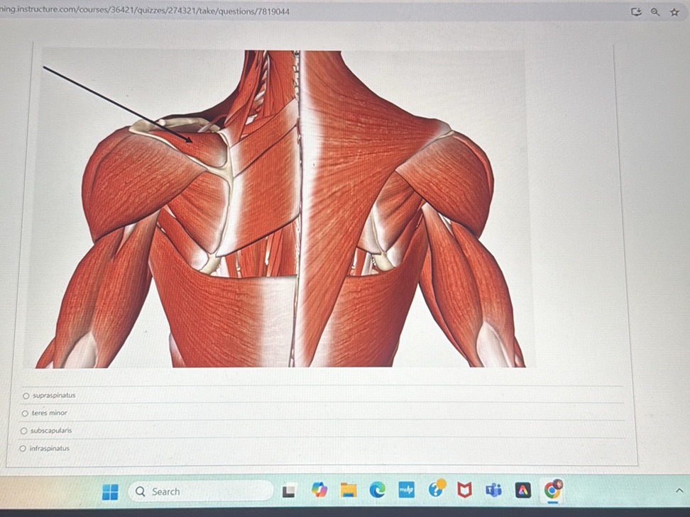 Which muscle is indicated by the arrow? O | StudyX