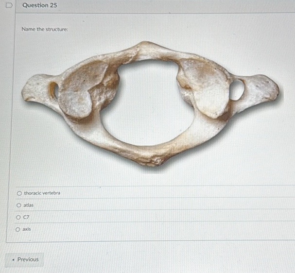 Name the structure: thoracic vertebra | StudyX