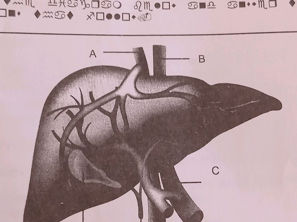 The image shows a diagram of the liver with | StudyX