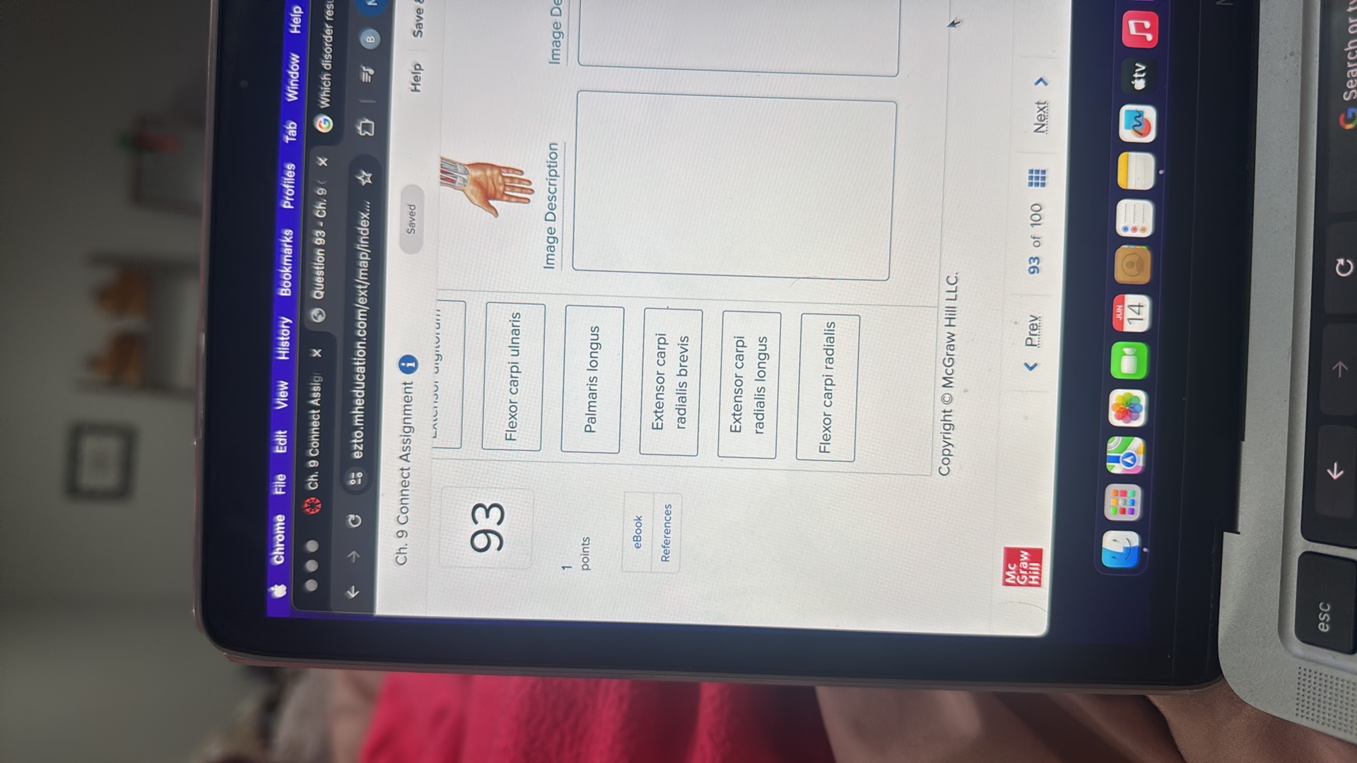 The image shows two diagrams of the forearm | StudyX