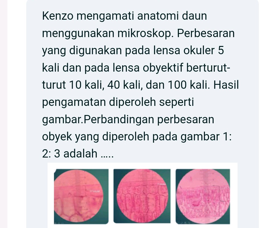 Kenzo mengamati anatomi daun menggunakan | StudyX