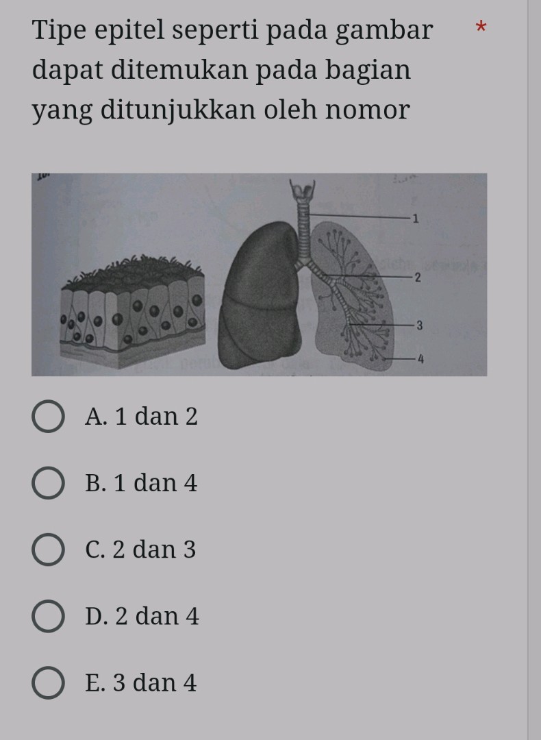 Tipe epitel seperti pada gambar dapat | StudyX