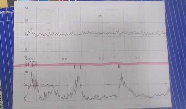 The image contains a graph showing two | StudyX