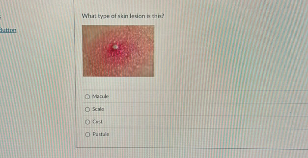 What type of skin lesion is this Macule | StudyX