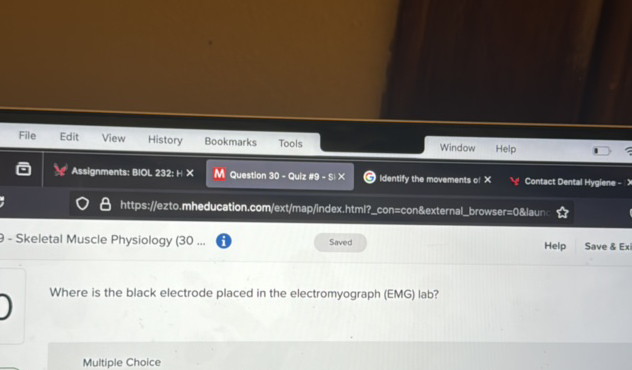 Where is the black electrode placed in the | StudyX