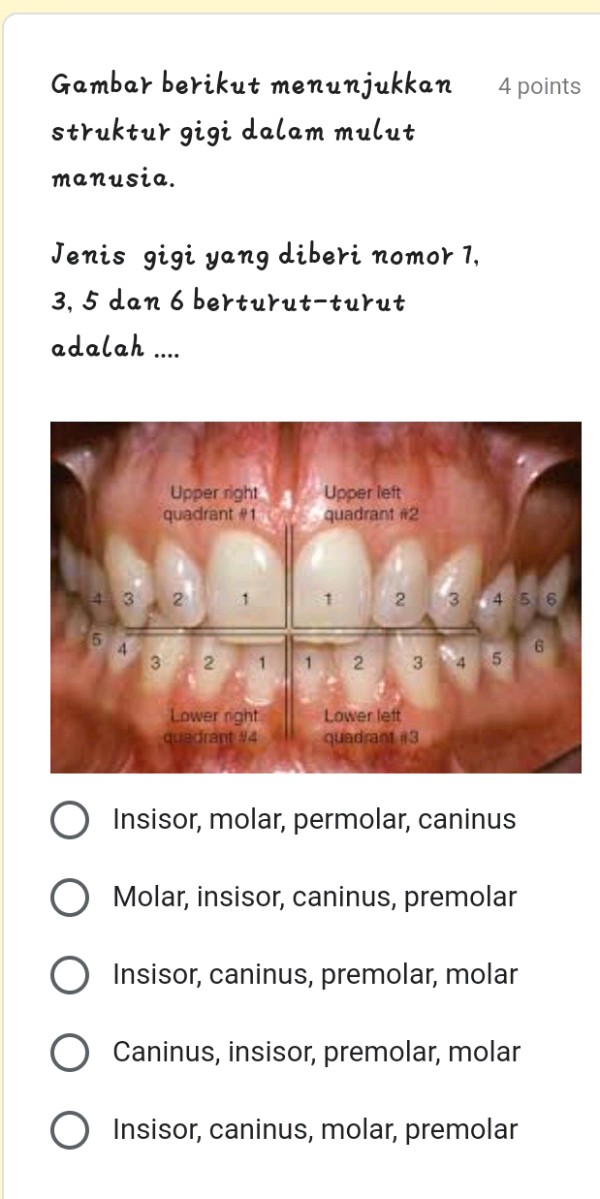 Gambar berikut menunjukkan struktur gigi | StudyX