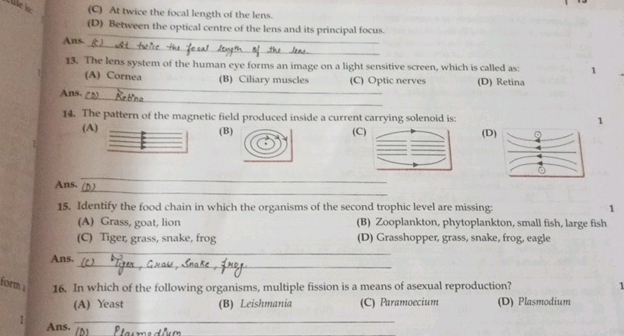 13 The lens system of the human eye forms an | StudyX