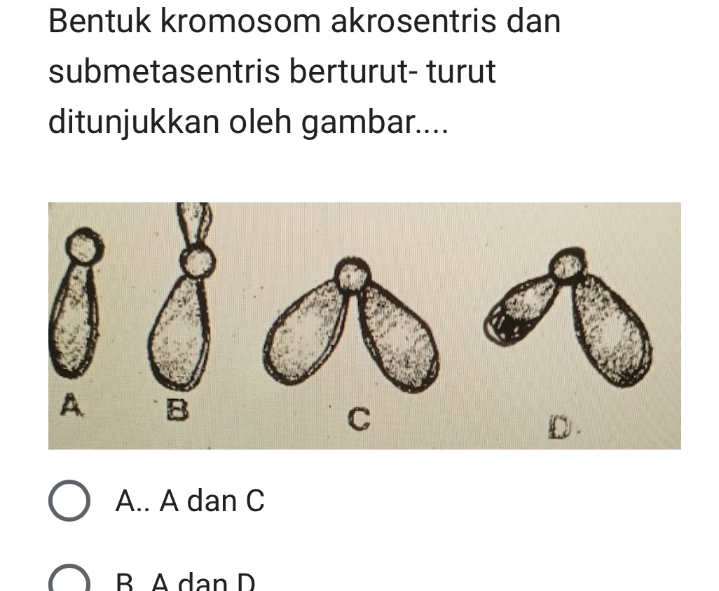 Bentuk kromosom akrosentris dan | StudyX