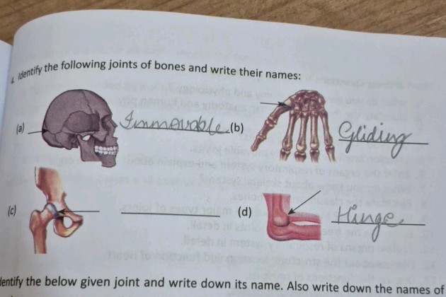 Identify the following joints of bones and | StudyX