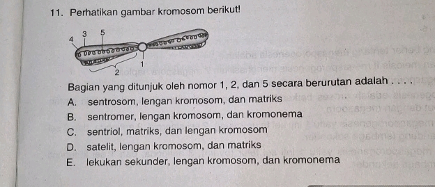 11 Perhatikan gambar kromosom berikut Gambar | StudyX