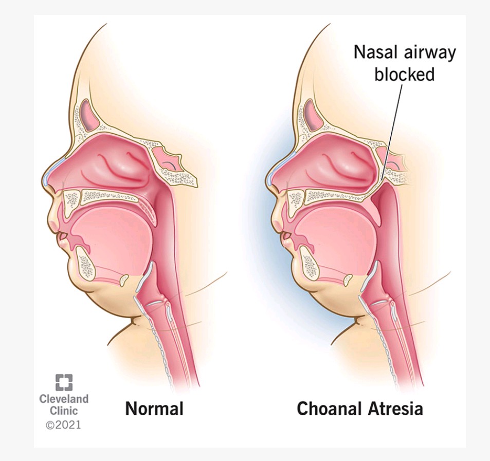 The image shows two diagrams illustrating | StudyX