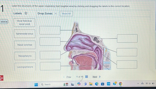 Label the structures of the upper