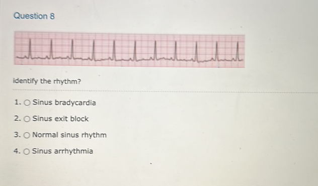 Question 8 identify the rhythm 1 Sinus | StudyX