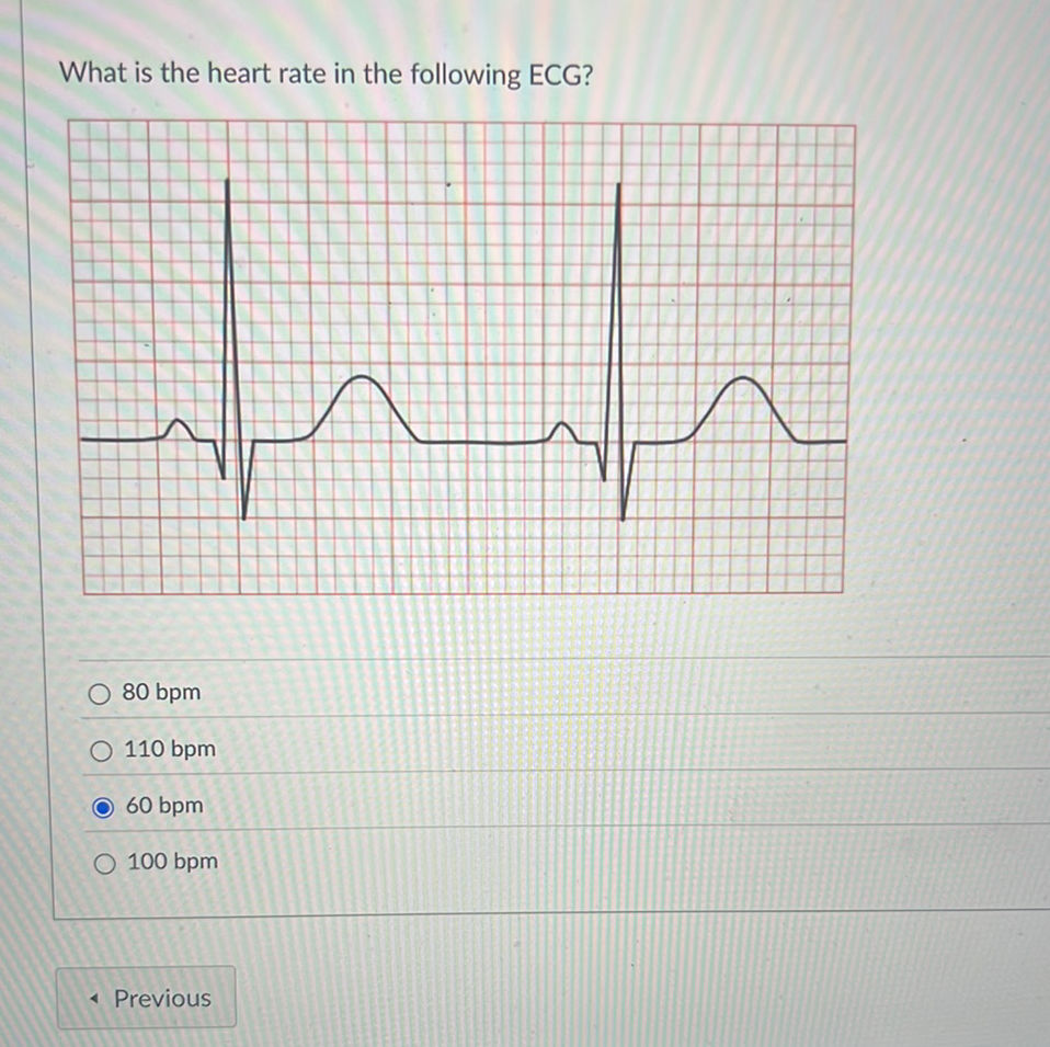 What is the heart rate in the following ECG? | StudyX