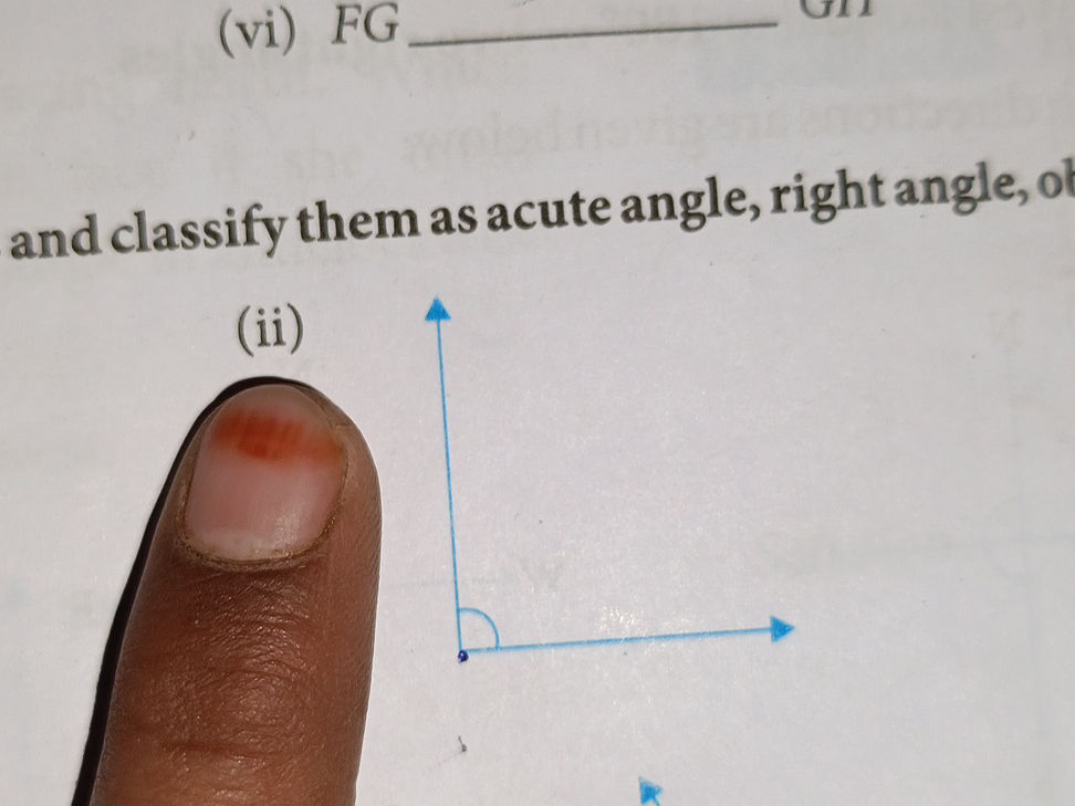 Classify the angle shown in the image as | StudyX