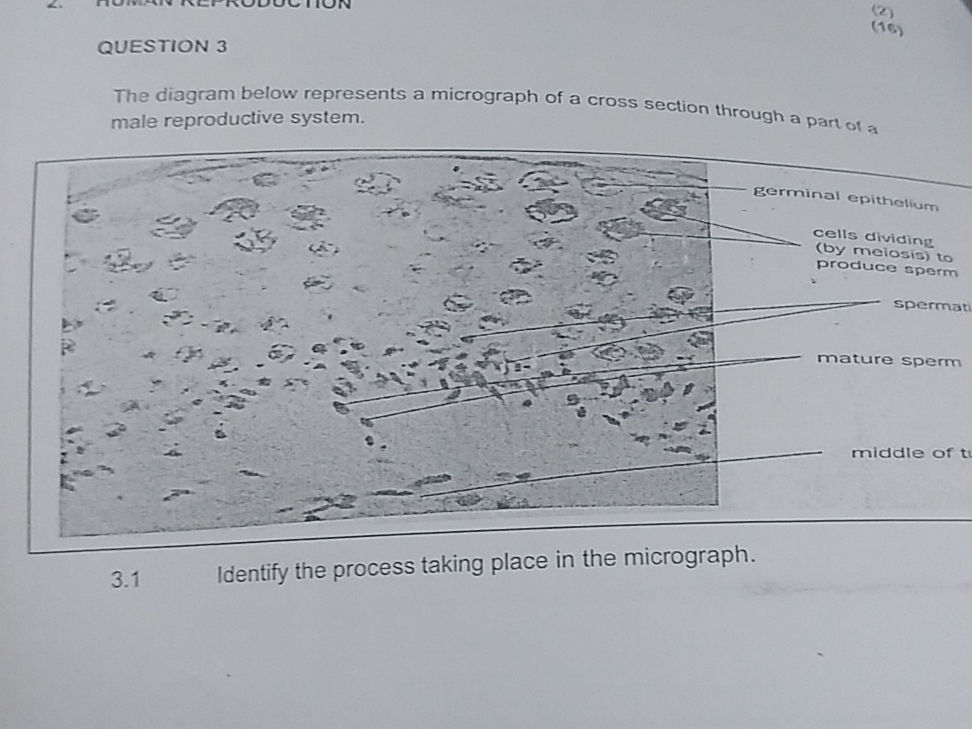 The diagram below represents a micrograph of | StudyX