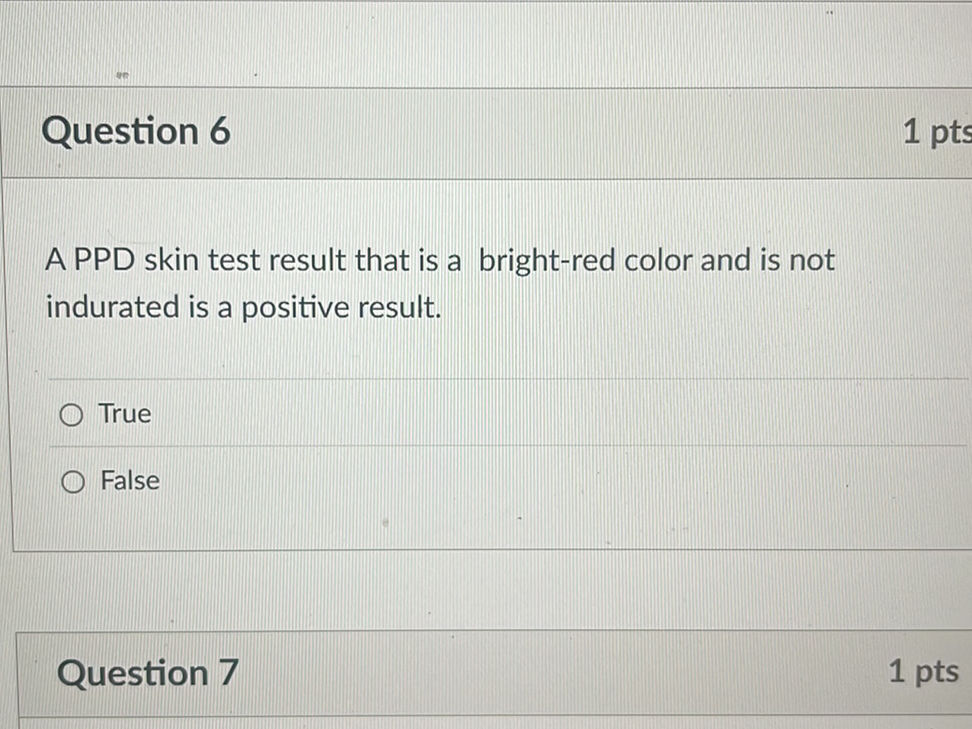 A PPD skin test result that is a bright-red | StudyX