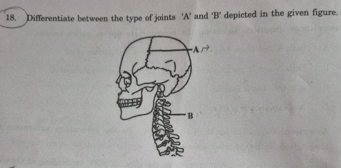 18. Differentiate between the type of joints | StudyX