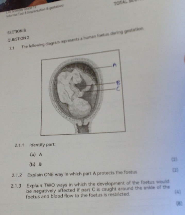 2.1 The following diagram represents a human | StudyX